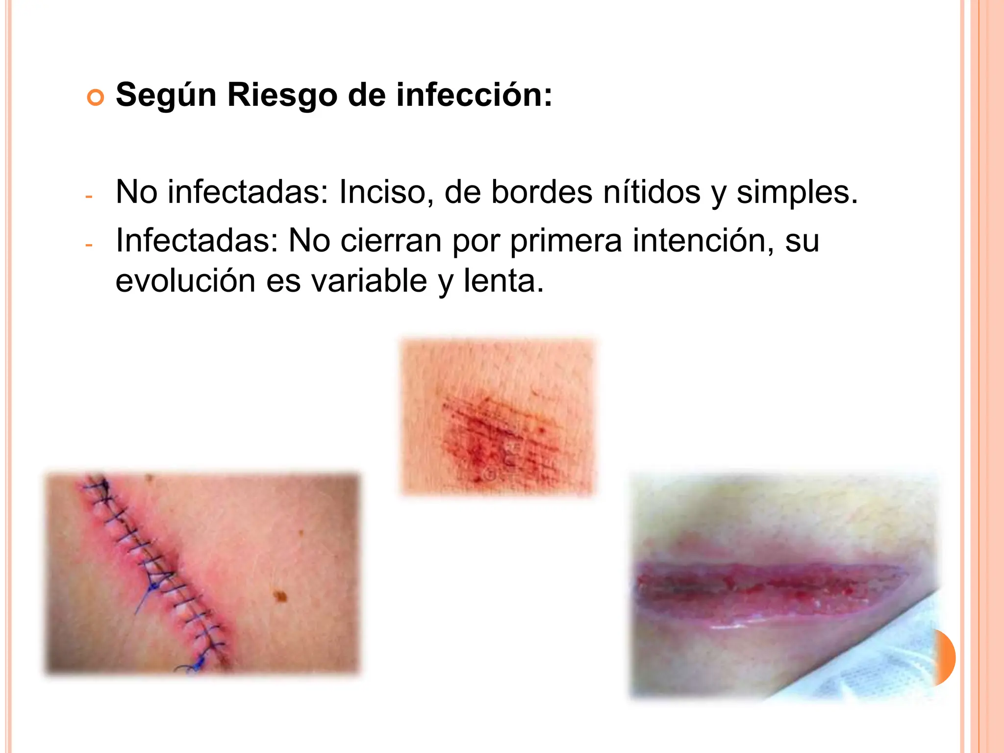 MANEJO Y CURACION DE HERIDAS.pptx