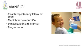 MANEJO Y TRATAMIENTO FRACTURA SUPRACONDÍLEA GARTLAND II –.pptx