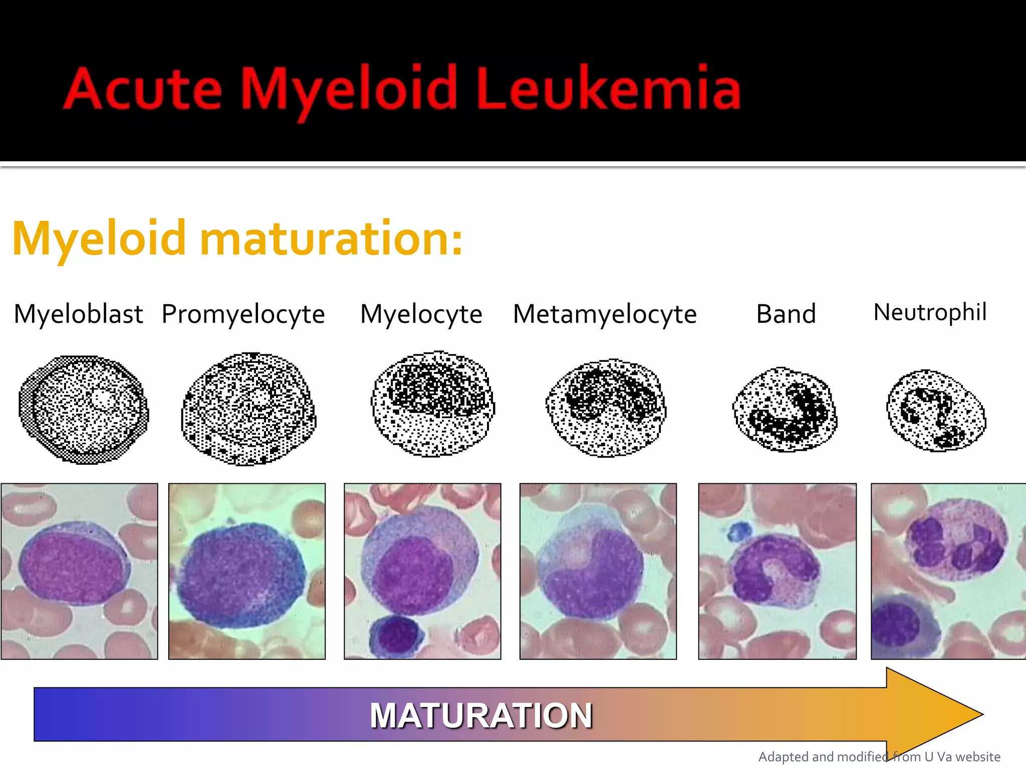 Leukemias-basic pathology | PPTX