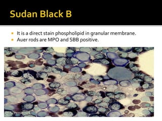 Leukemias-basic pathology | PPTX