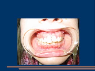 Case MC | PPT
