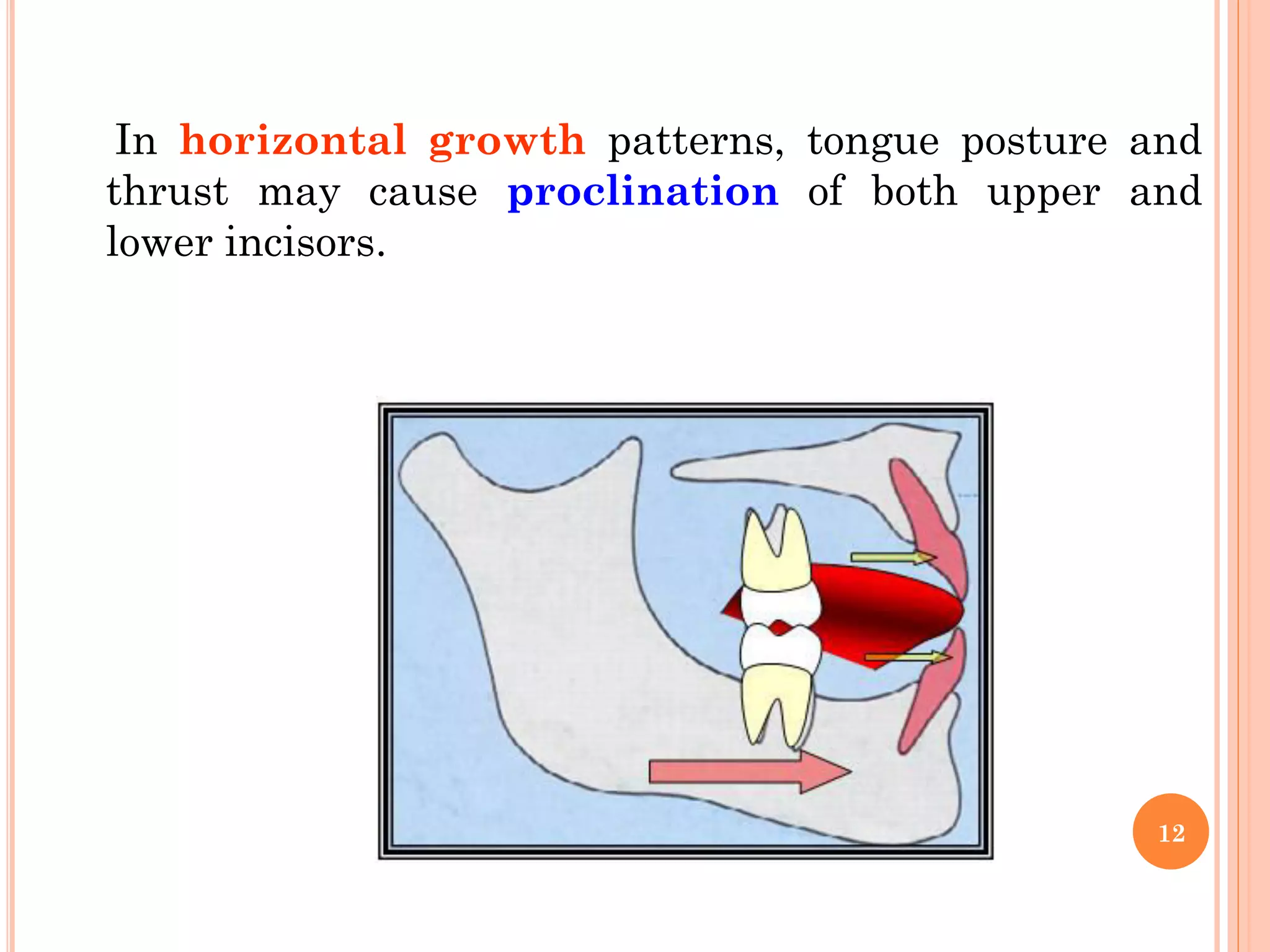 Mangement of openbite in orthodontics | PDF
