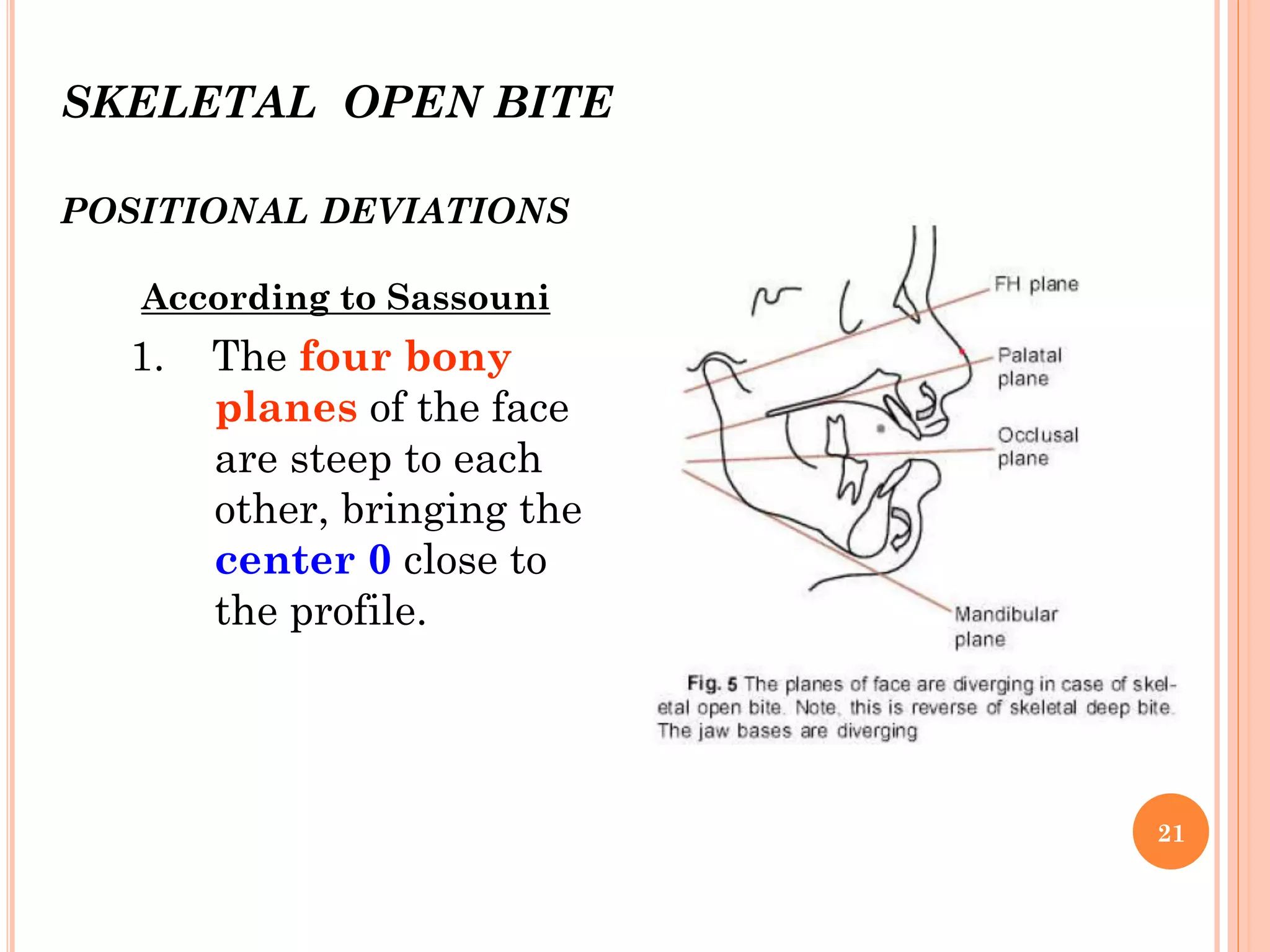 Mangement of openbite in orthodontics | PDF