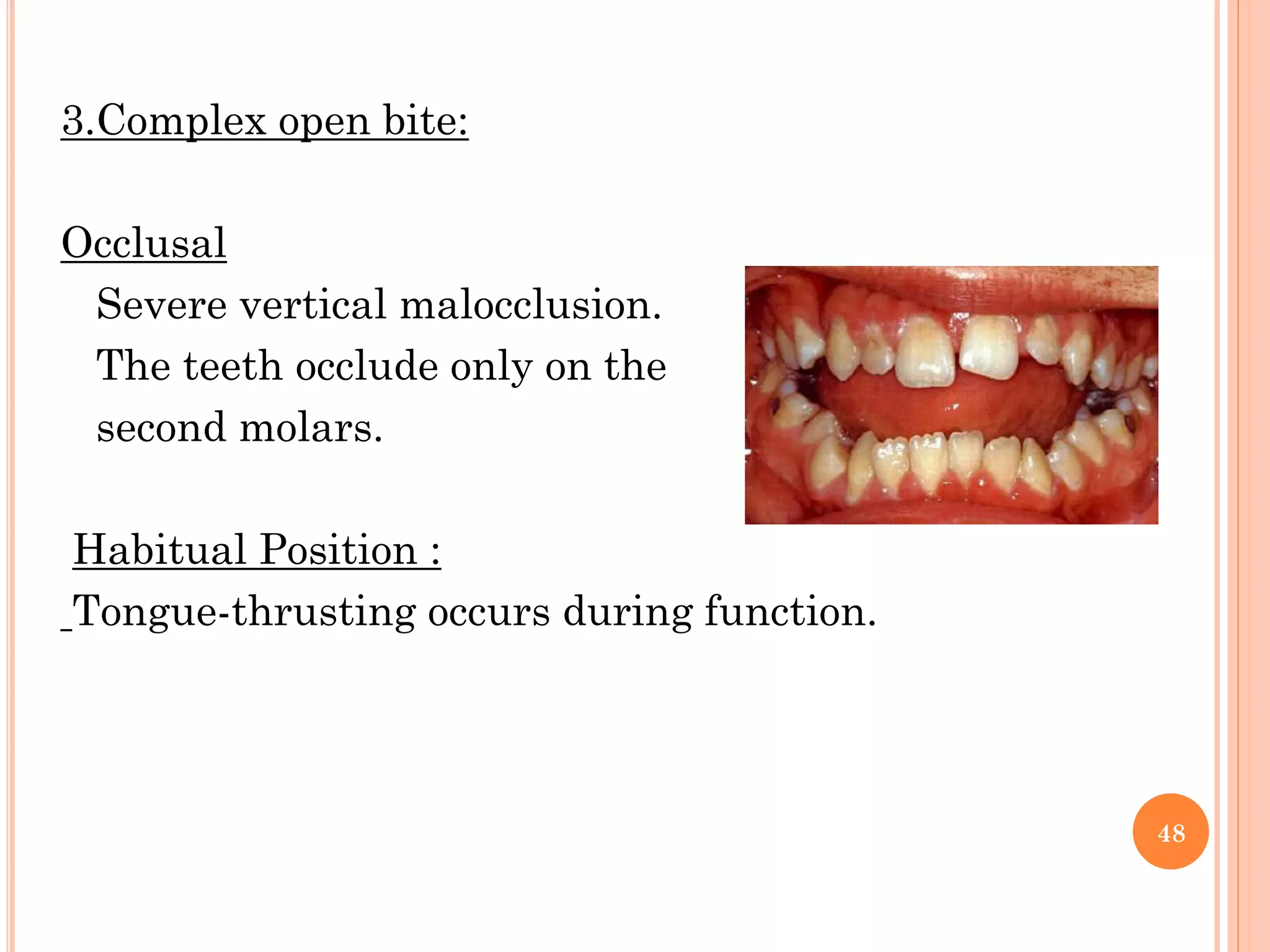Mangement of openbite in orthodontics | PDF