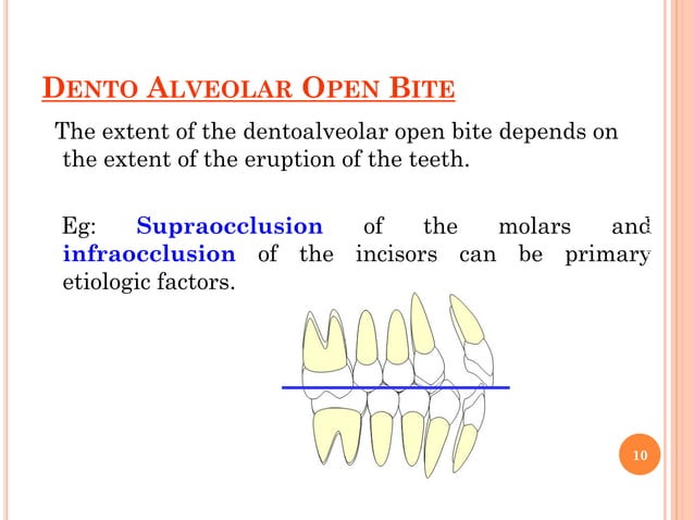 Mangement of openbite in orthodontics | PDF | Dental Health | Diseases ...