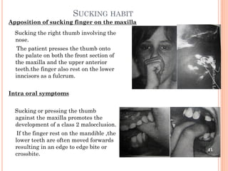 Mangement of openbite in orthodontics | PDF
