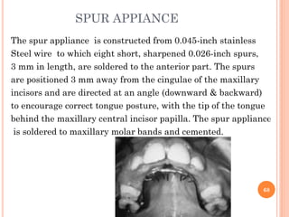 Mangement of openbite in orthodontics | PDF