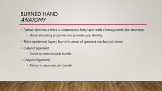 Mangled and Burned Hand.pptx