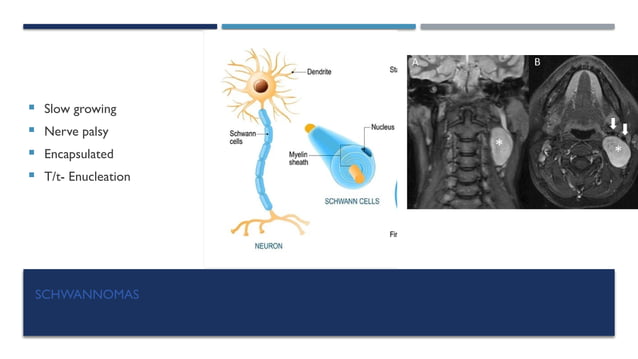 Management of parapharyngeal space tumours.pptx