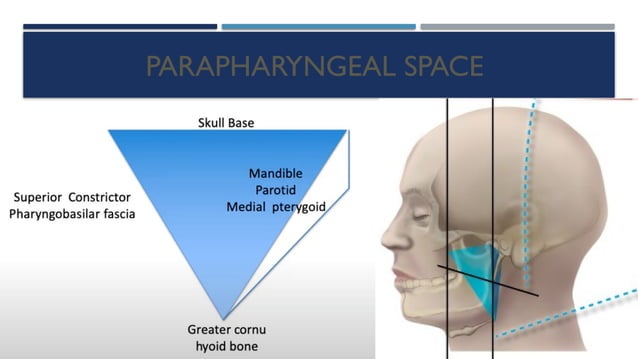 Management of parapharyngeal space tumours.pptx