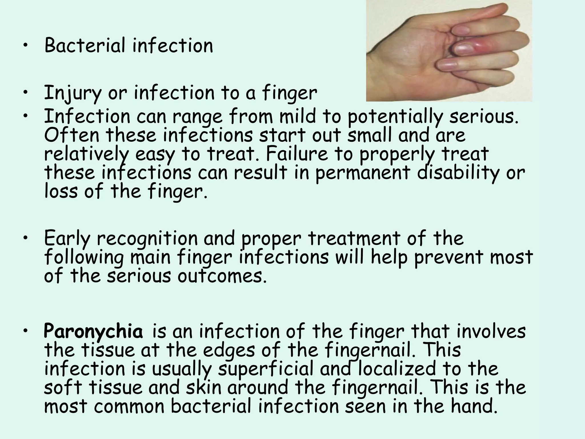 Manicure introduction | PPT