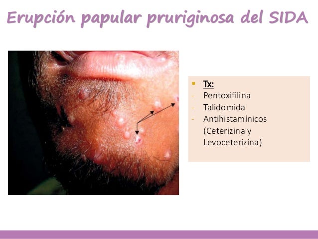 Manifestaciones Cutáneas del VIH