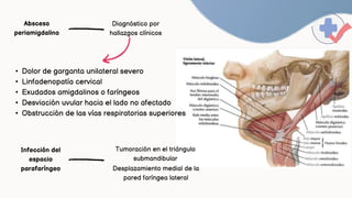 manifestaciones clinicas de abscesos.pptx