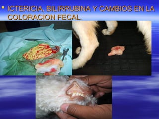 MANIFESTACIONES CLINICAS DE ENFERMEDAD HEPATOBILIAR.ppt