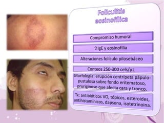 Manifestaciones dermatolgicas del sida | PPTX