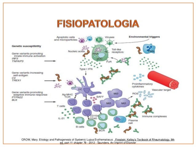 Manifestaciones pulmonares del lupus eritematoso sistémico
