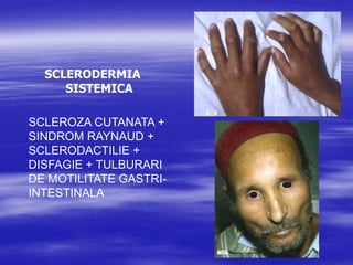 Manifestari cutanate in bolile digestive | PPT