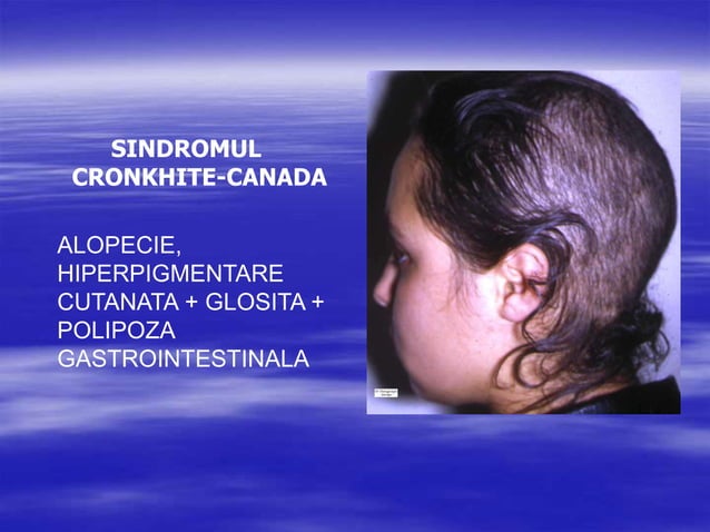 Manifestari cutanate in bolile digestive | PPT