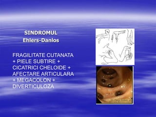 Manifestari cutanate in bolile digestive | PPT