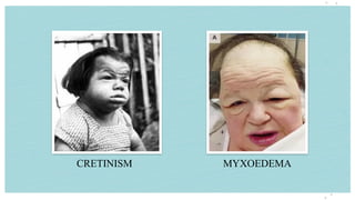 Manifestation of Systemic Diseases in Oral Cavity revised.pptx