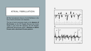 Manifestations of Cardiovascular Disorders on Doppler Interrogation of ...