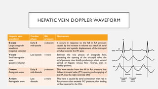 Manifestations of Cardiovascular Disorders on Doppler Interrogation of ...
