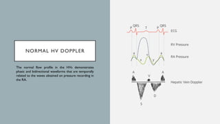 Manifestations of Cardiovascular Disorders on Doppler Interrogation of ...