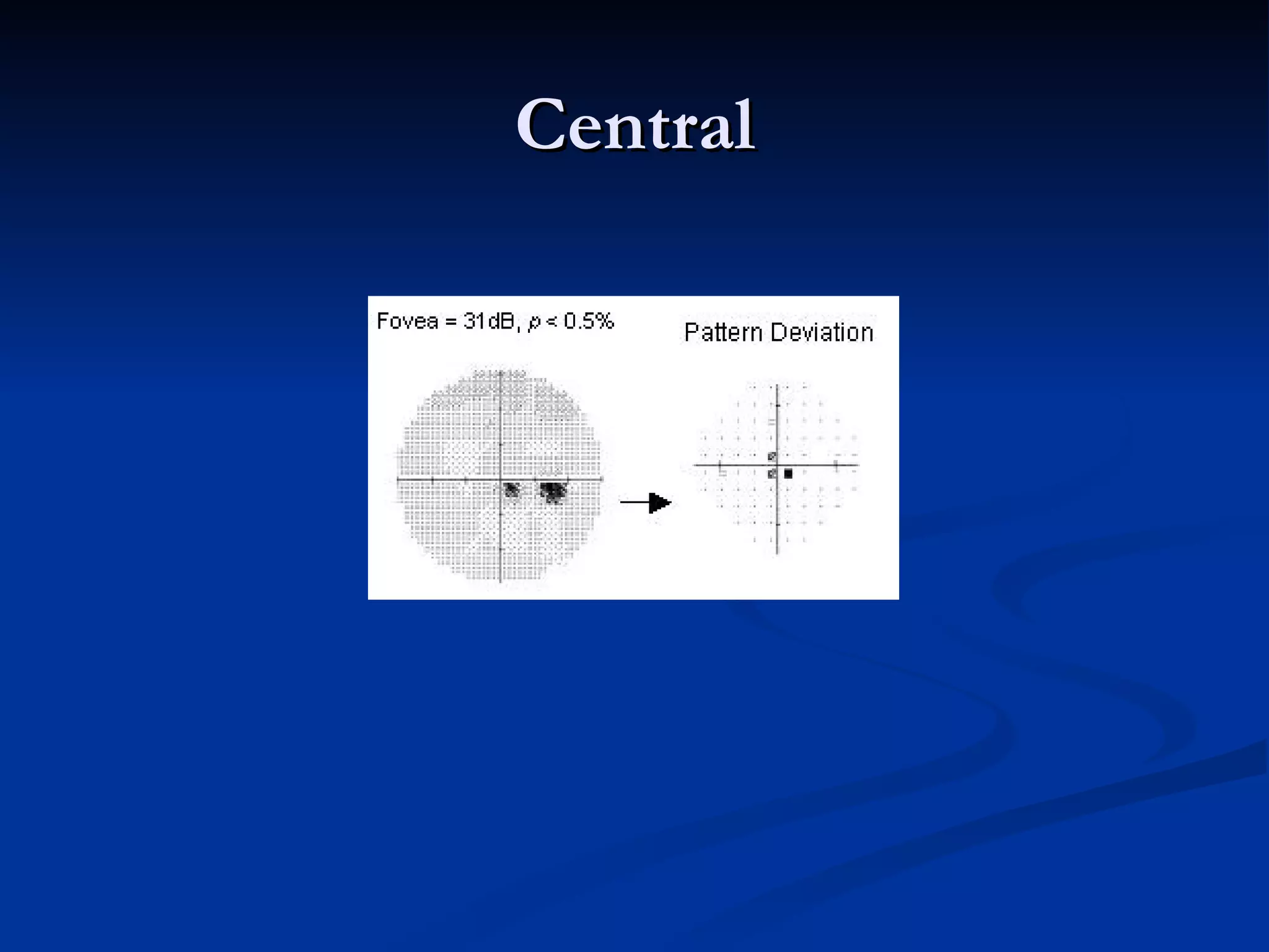 Anatomy and Lesions of Visual Pathways | PPT