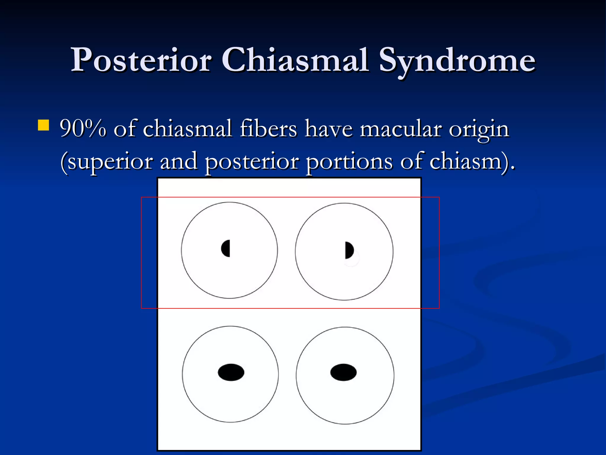 Anatomy and Lesions of Visual Pathways | PPT