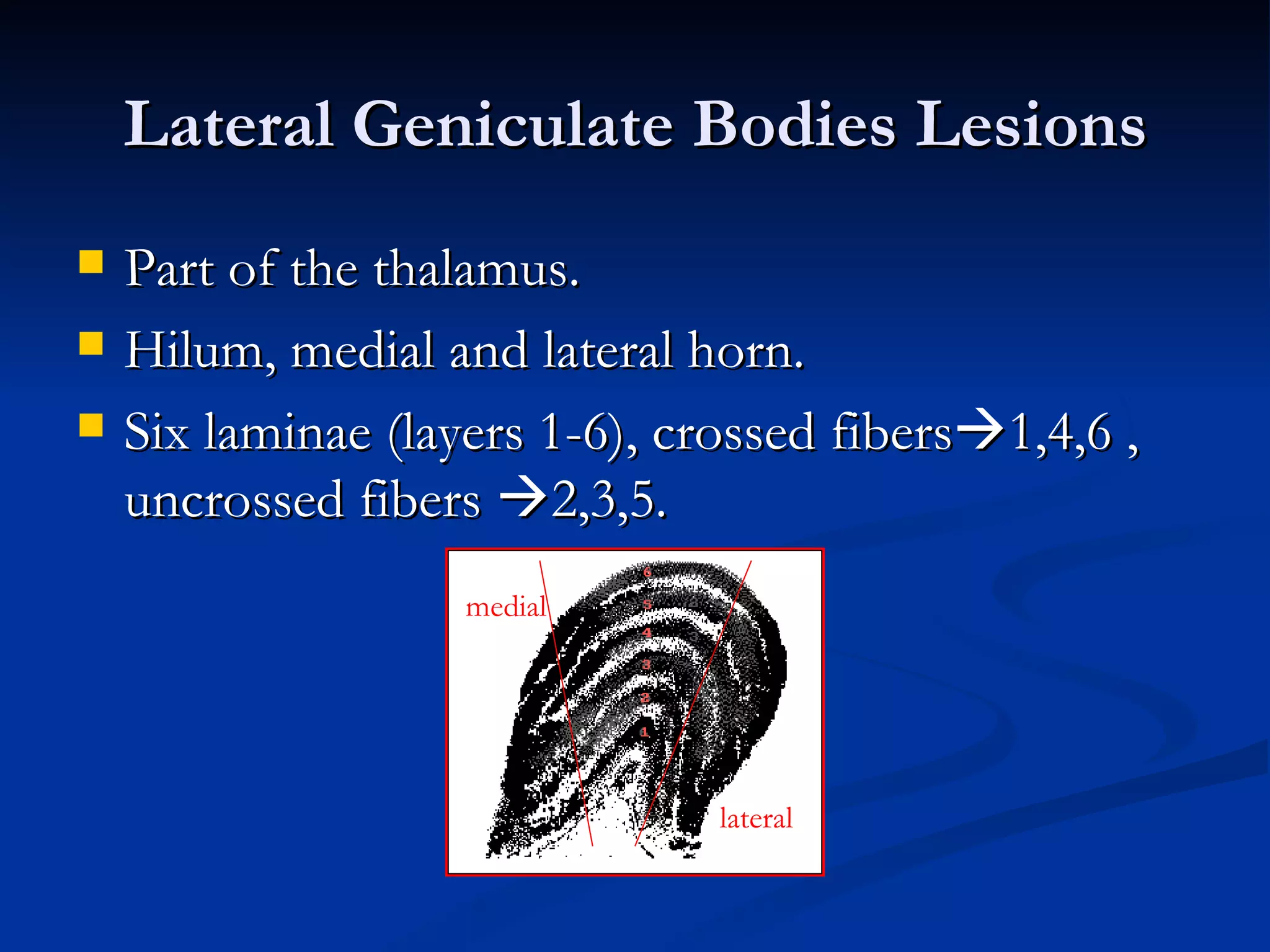 Anatomy and Lesions of Visual Pathways | PPT