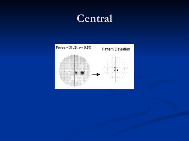 Anatomy and Lesions of Visual Pathways | PPT | Brain and Nervous System ...