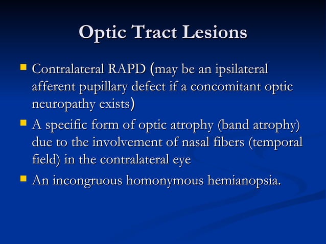 Anatomy and Lesions of Visual Pathways | PPT | Brain and Nervous System ...