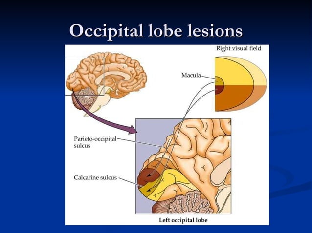 Anatomy and Lesions of Visual Pathways | PPT | Brain and Nervous System ...