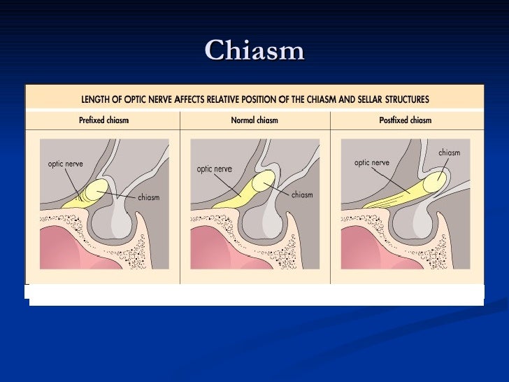 Anatomy and Lesions of Visual Pathways