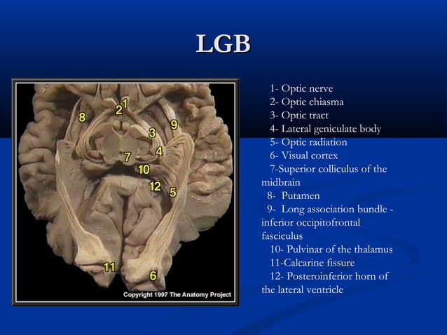 Manifestations of visual pathway lesions | PPT | Brain and Nervous ...