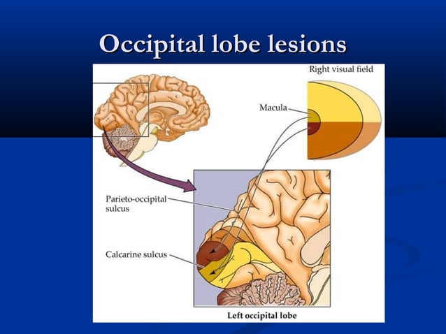Manifestations of visual pathway lesions | PPT | Brain and Nervous ...