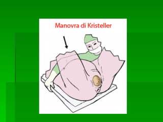 Maniobra De Kristeller | PPT