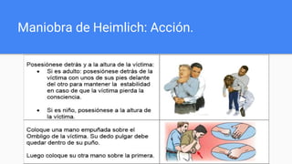 Maniobra de heimlich | PPTX