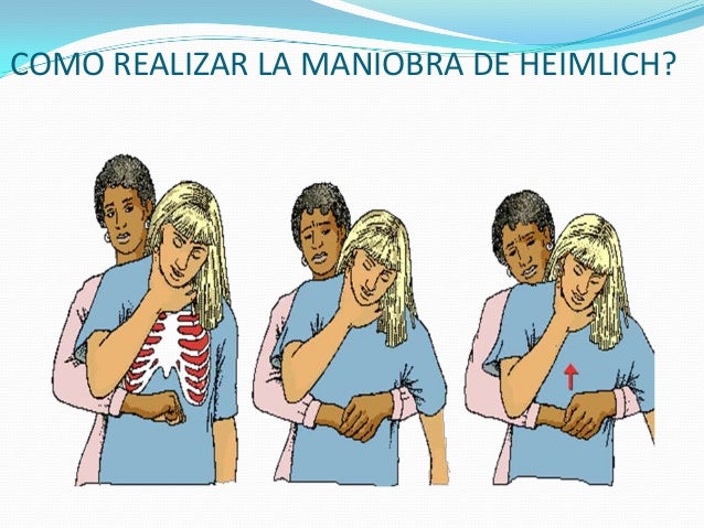 Primeros auxilios: MANIOBRA DE HEIMLICH