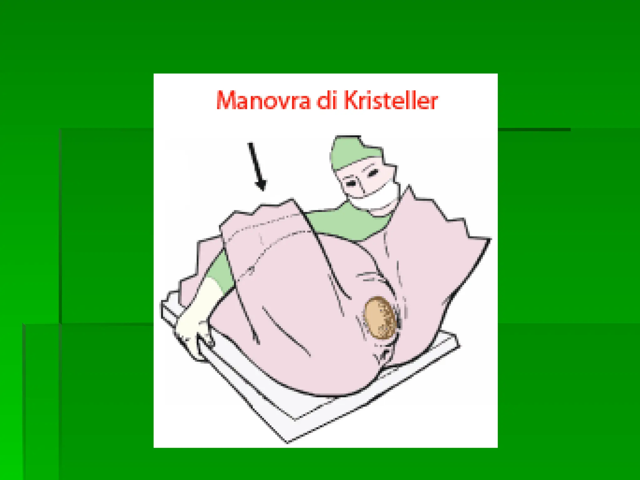 Maniobra de Kristeller. manual de ginecologia.ppt