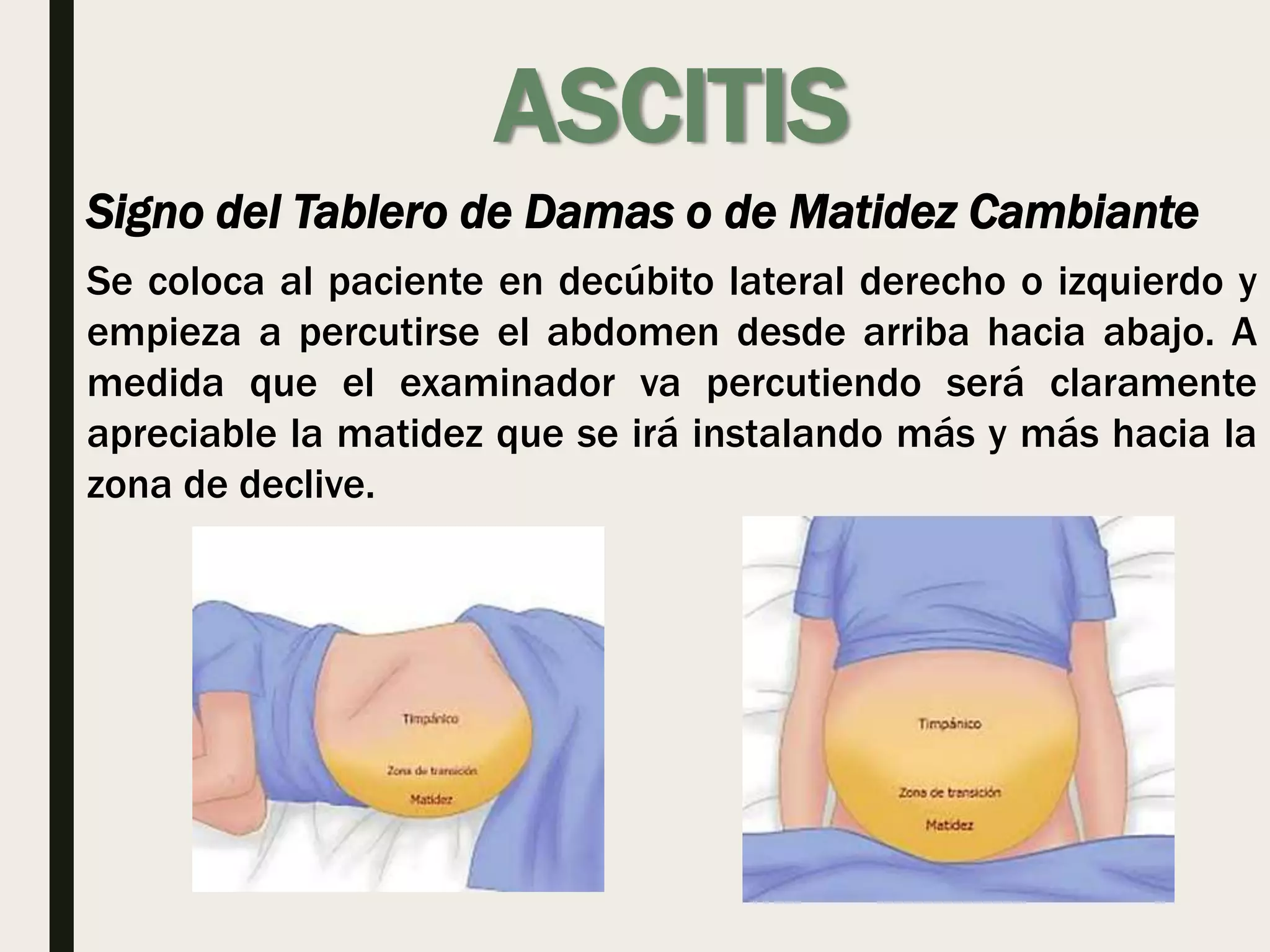 Maniobras de Exploración Abdominal | PPTX