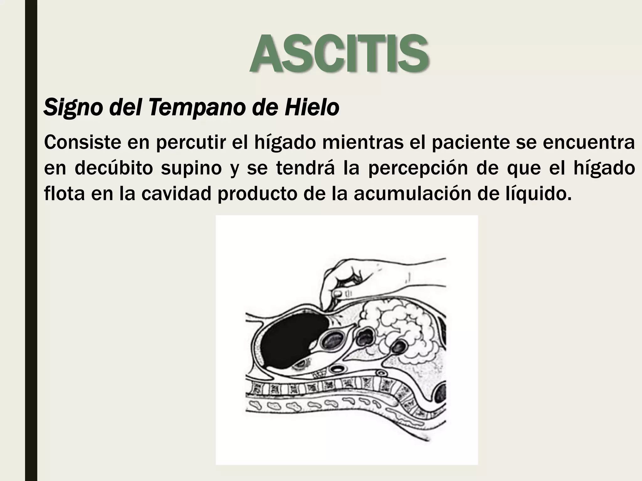 Maniobras de Exploración Abdominal | PPTX
