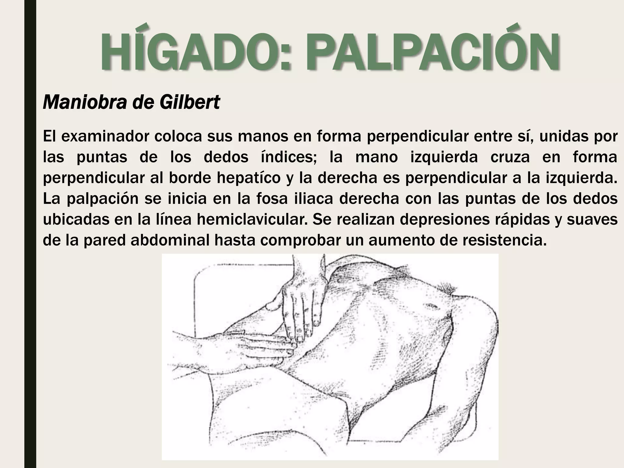 Maniobras de Exploración Abdominal | PPTX