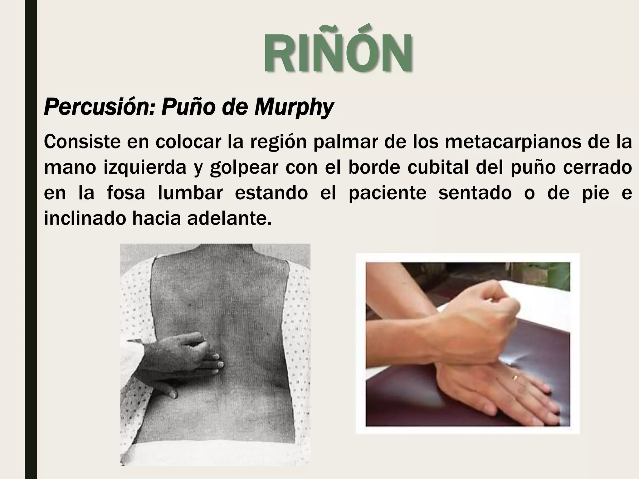 Maniobras de Exploración Abdominal | PPTX