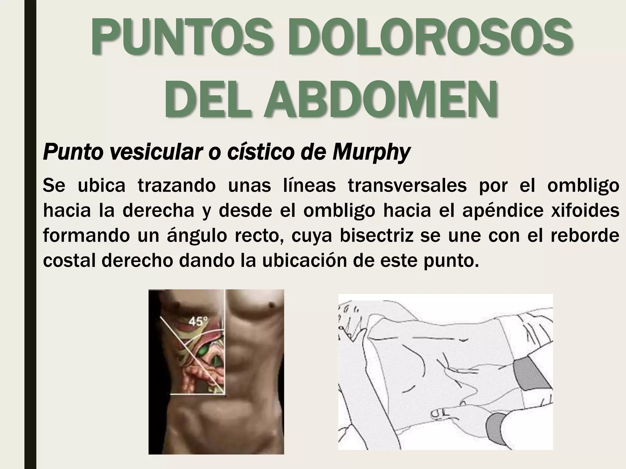 Maniobras de Exploración Abdominal | PPTX