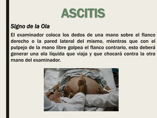 Maniobras de Exploración Abdominal | PPTX