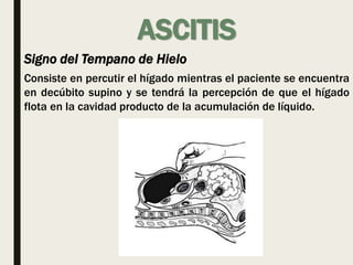 Maniobras de Exploración Abdominal | PPTX