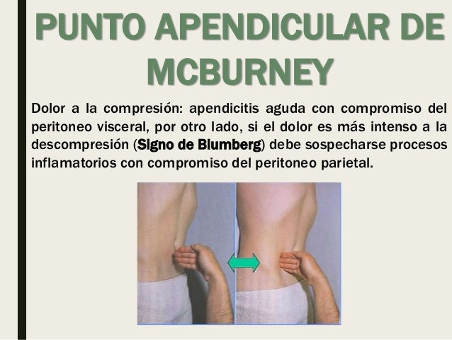 Maniobras De Exploración Abdominal