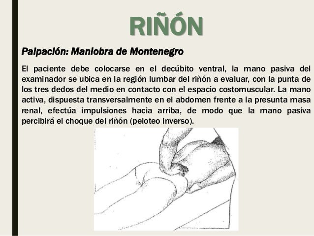 Maniobras de Exploración Abdominal