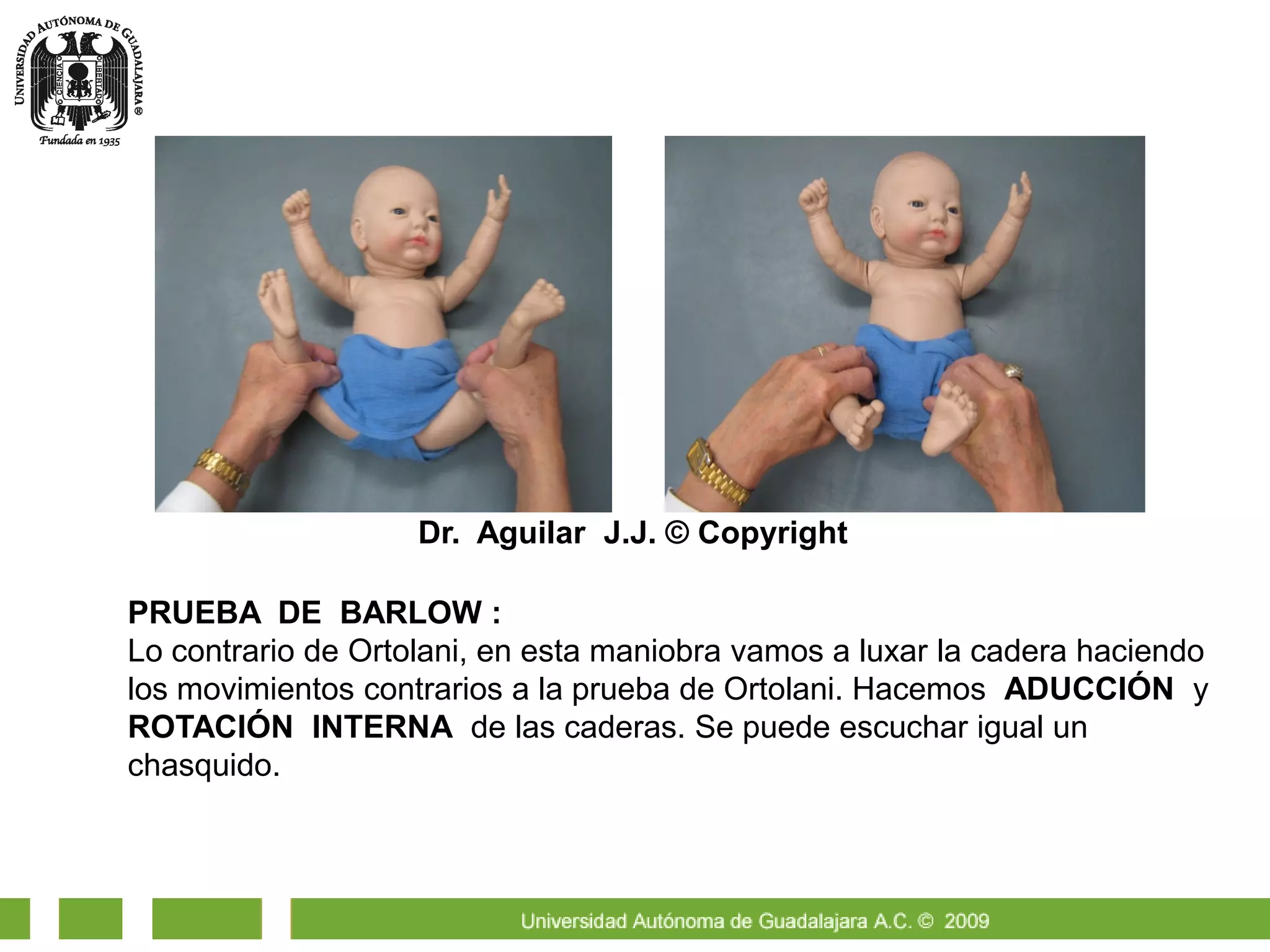Maniobras de la Exploracion Fisica - UAG MX, Ortopedia y Traumatologia ...